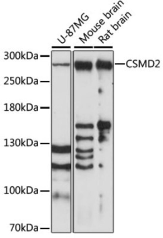 CSMD2 Rabbit anti-Human, Mouse, Rat, Polyclonal, Novus Biologicals 20 μg; | Fisher Scientific